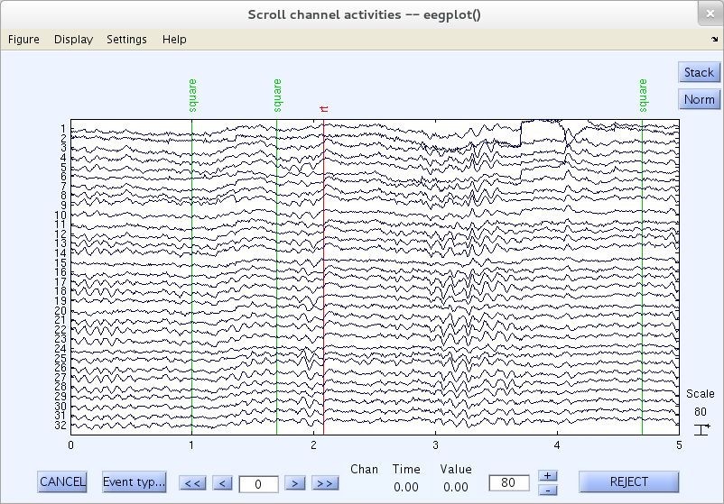 GUÍA BÁSICA DE PRE-PROCESAMIENTO MEDIANTE EEGLAB | Grupo Neuropsicología y Conducta