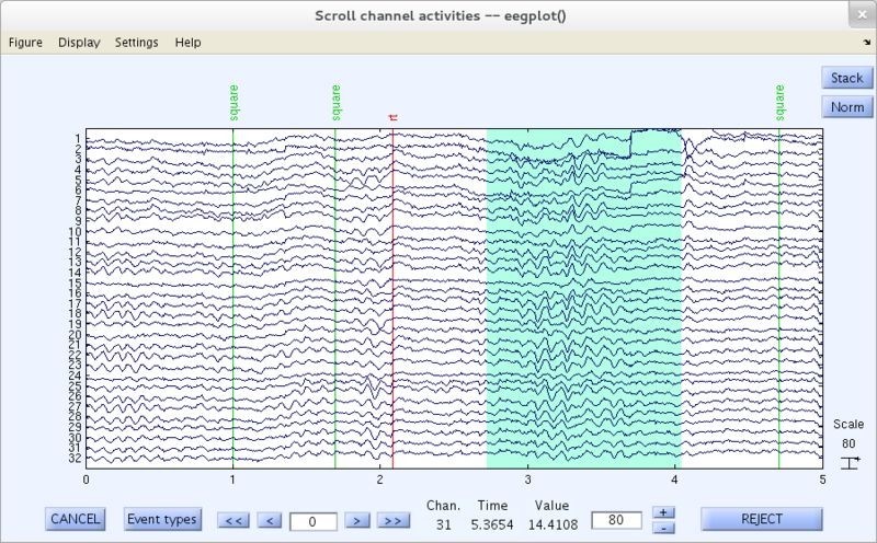 GUÍA BÁSICA DE PRE-PROCESAMIENTO MEDIANTE EEGLAB | Grupo Neuropsicología y Conducta